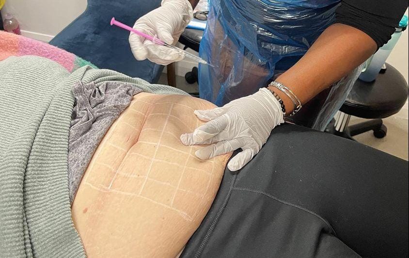 IV Vitamin Infusion Treatment in Southampton, England - Endulge Therapy